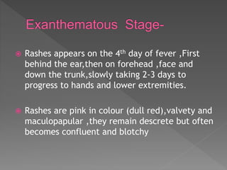 Epidemiology of measles | PPTX