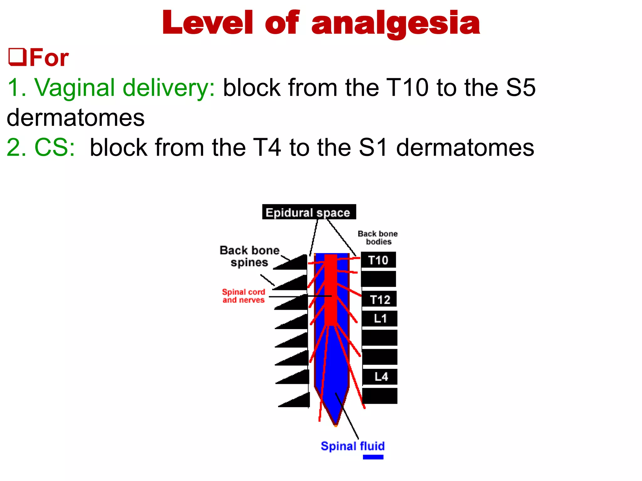 Epidural | PDF