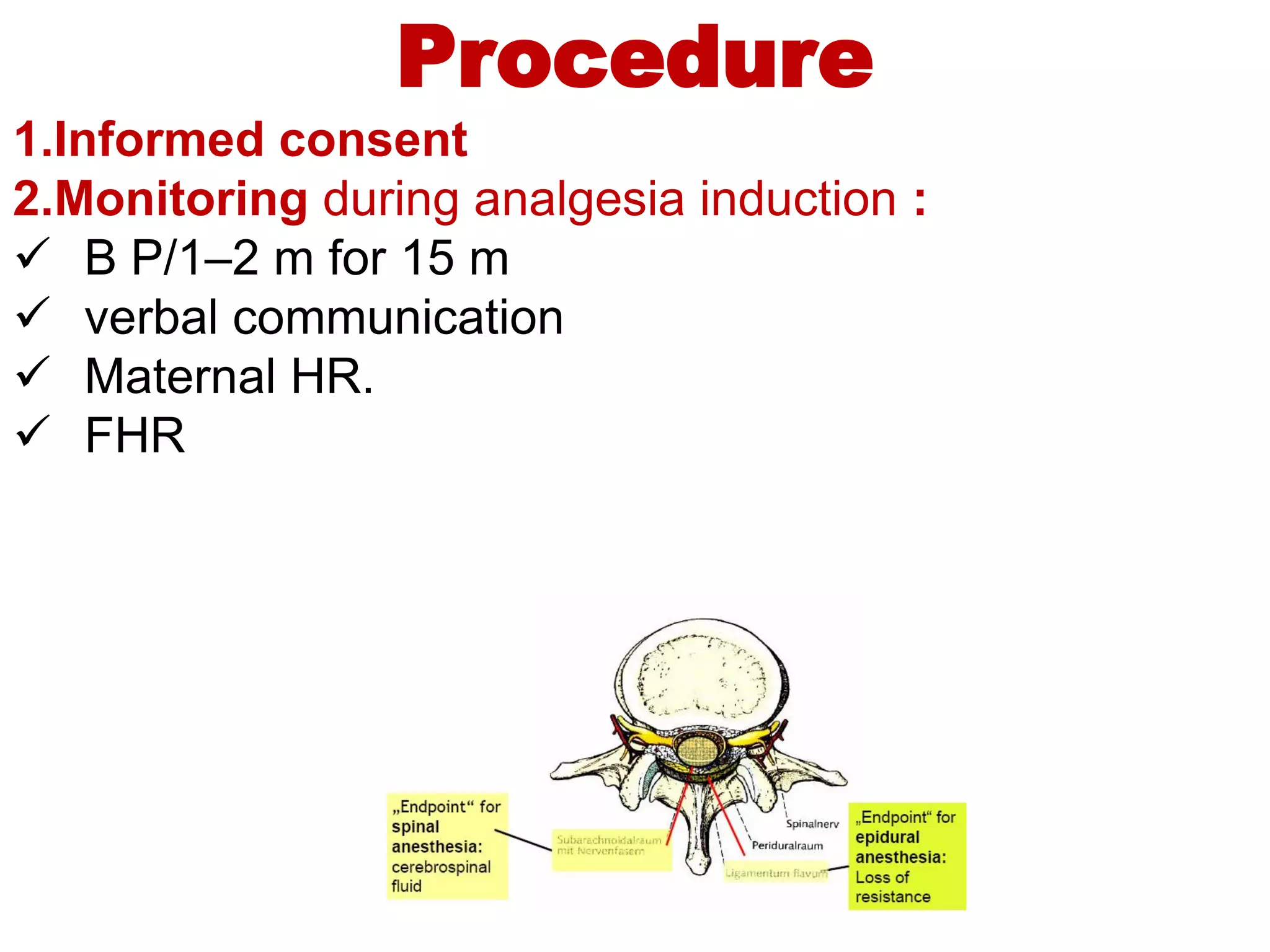 Epidural | PDF