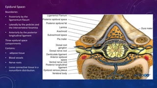 Epidural | PPTX