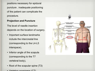 Epidural (1) | PPTX
