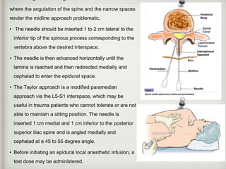 Epidural (1) | PPTX | Brain and Nervous System Disorders | Diseases and ...