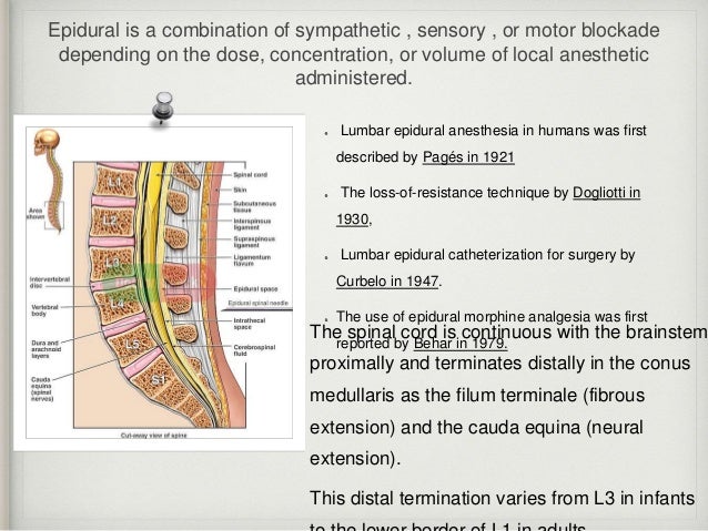 Epidural (1)