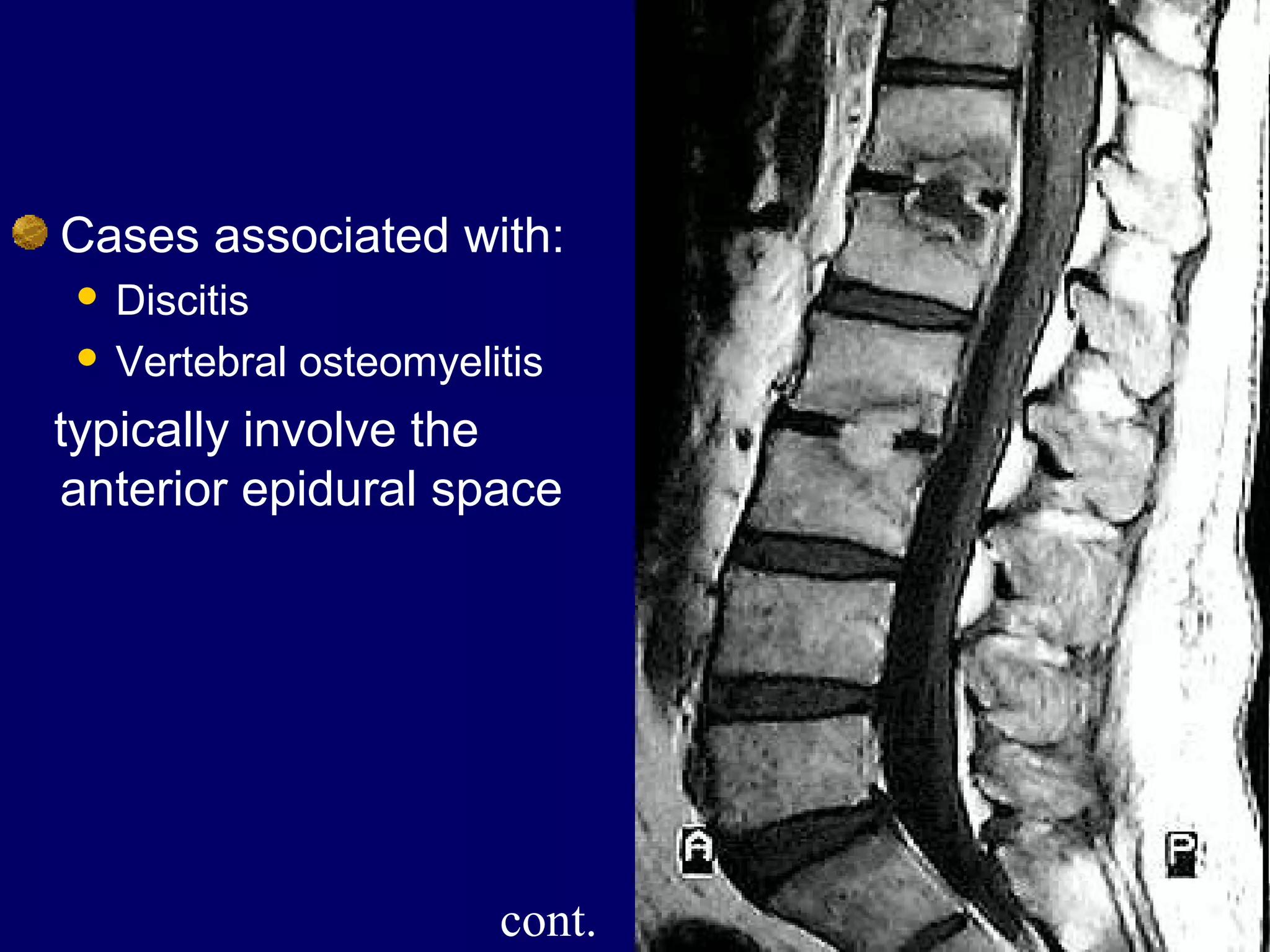 SPINAL EPIDURAL, AND SUBDURAL - INTRAMEDULLAR ABSCESSES | PPT