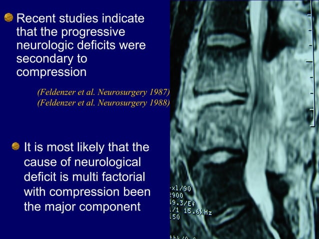 SPINAL EPIDURAL, AND SUBDURAL - INTRAMEDULLAR ABSCESSES | PPT