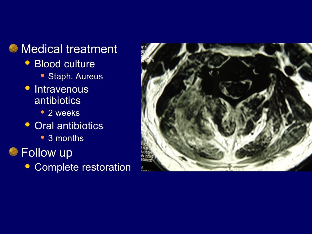 Epidural And Subdural Abscess