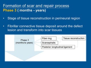 epidural adhesion prevention.pptx