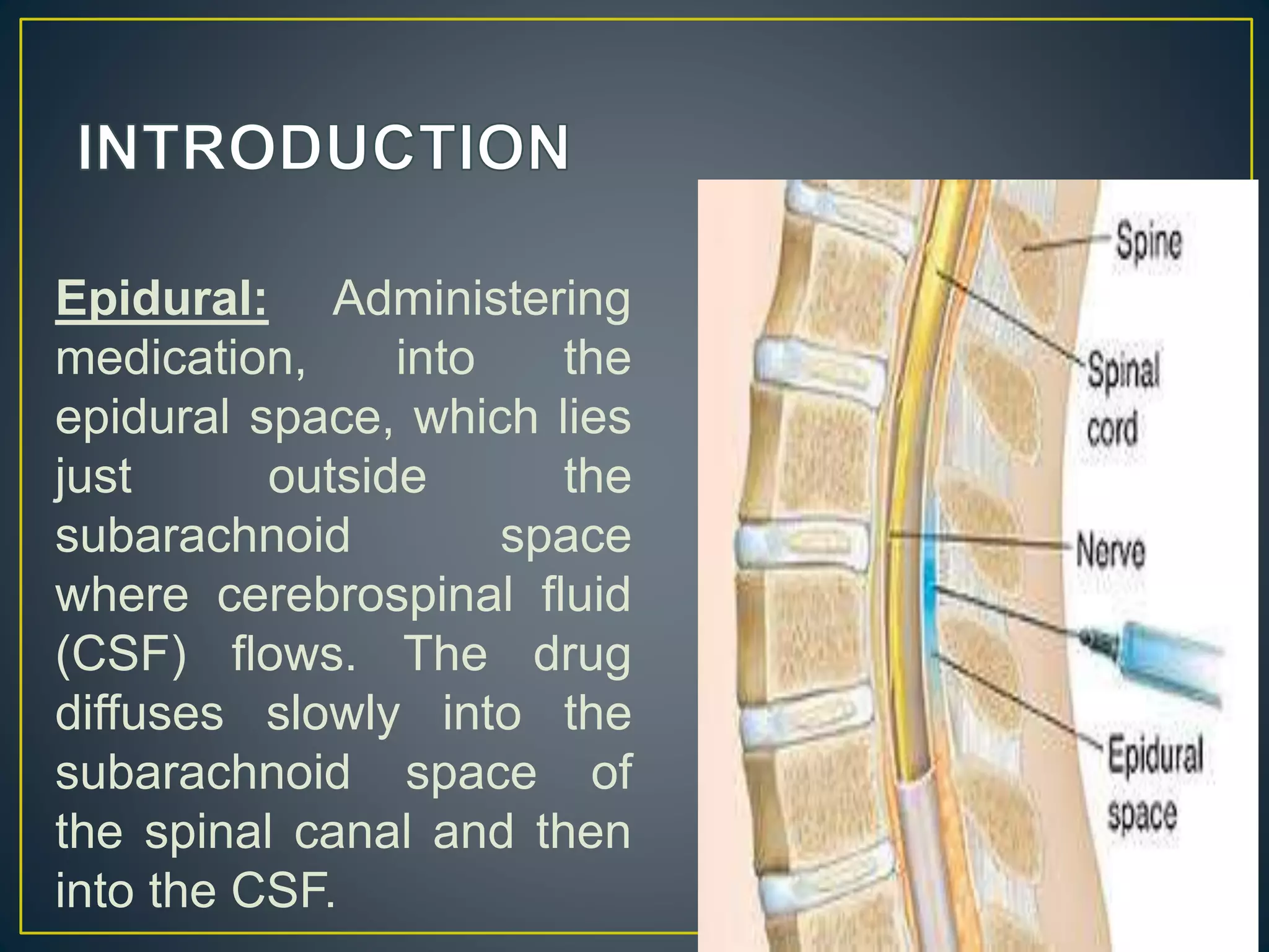 Epidural administration | PPTX