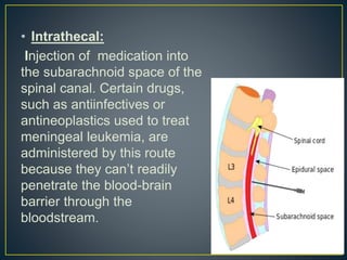 Intrathecal Injection