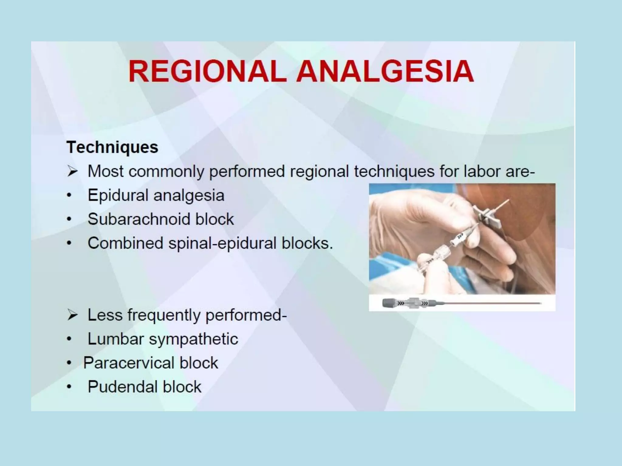 Epidural analgesia for labour | PDF