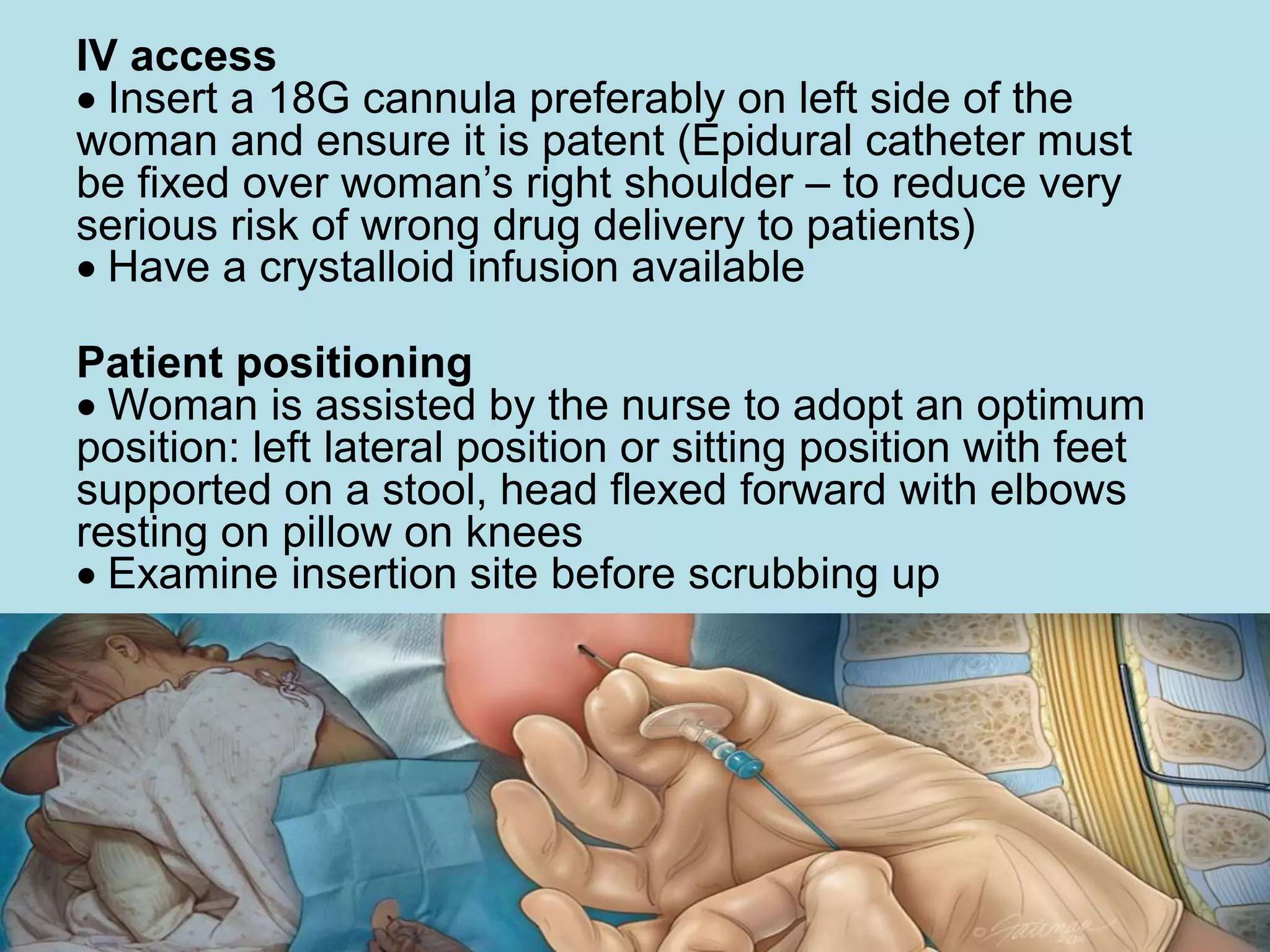 Epidural analgesia for labour | PDF