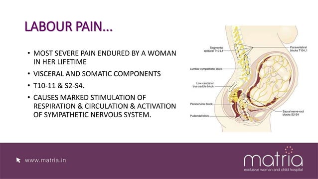 Epidural analgesia for labour | PPTX | Pregnancy | Reproductive Health