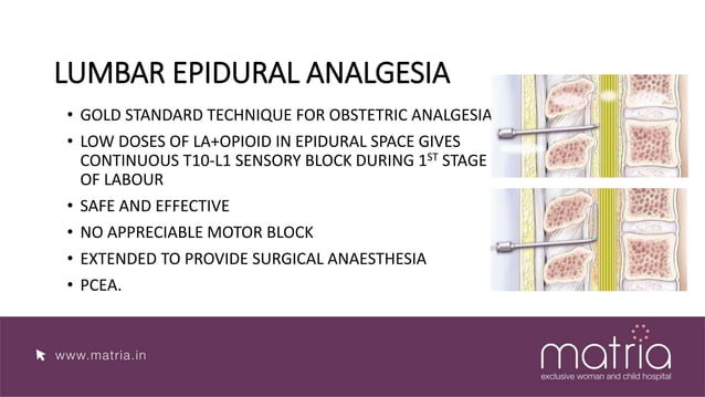 Epidural analgesia for labour | PPTX | Pregnancy | Reproductive Health