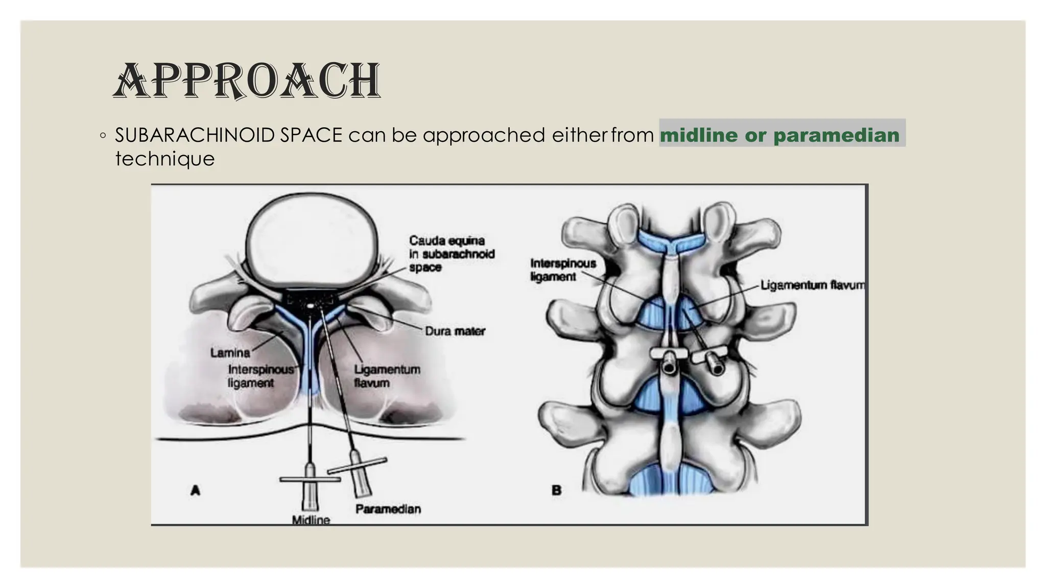 Epidural and spinal anaesthesia.for you alll | PDF
