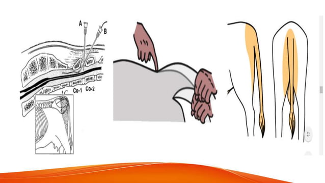 Epidural Anesthesia in Bovine | PPT | First Aid | Injuries