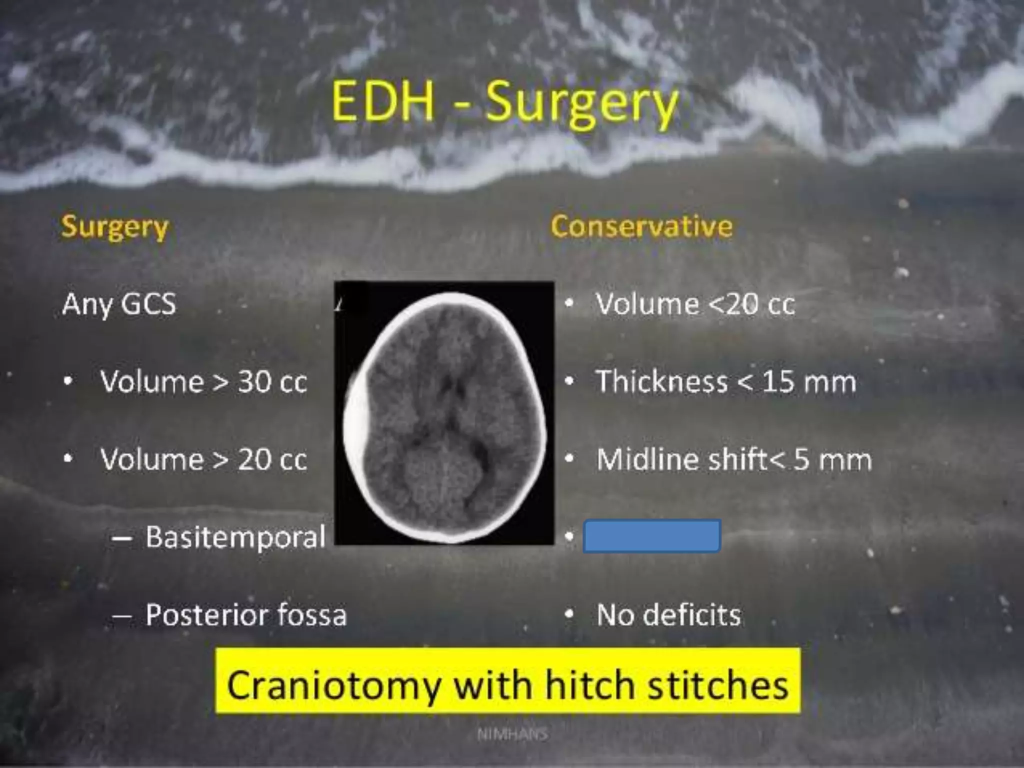Epidural haematoma extradural haemorrhage | PPTX