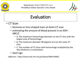 Epidural Hematom.pptx