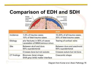 Epidural Hematoma Suture Lines