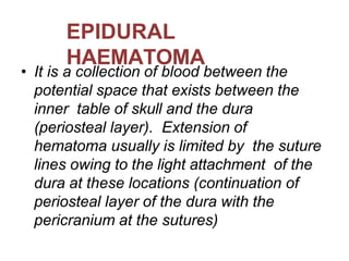 Epidural Hematoma