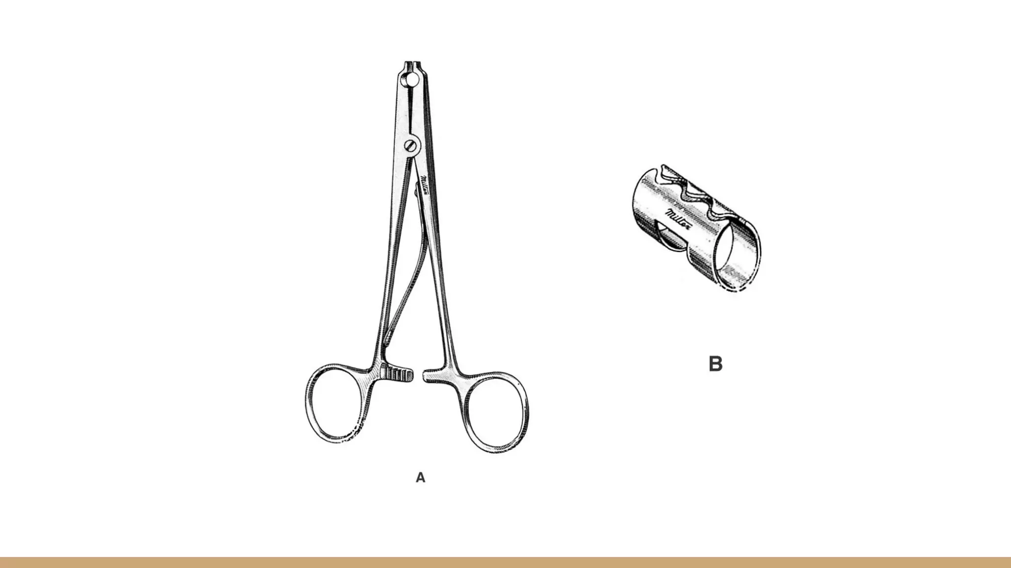 Trephine Epidural hematoma | PPT