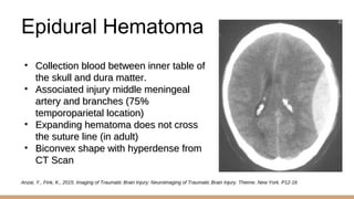 Trephine Epidural hematoma | PPT