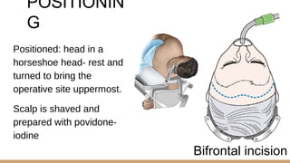 Trephine Epidural hematoma | PPT