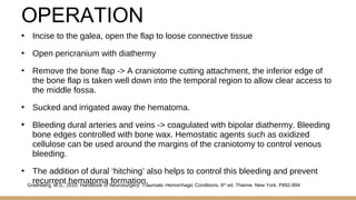 Trephine Epidural hematoma | PPT