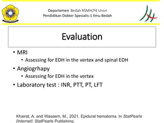 Epidural Hematom.pptx