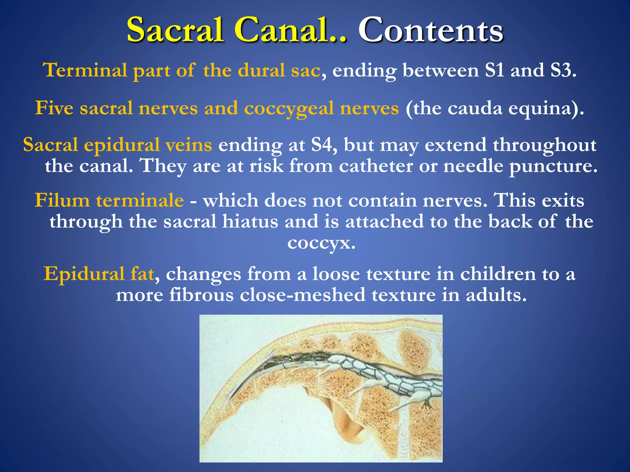 Epidural Injections Ppt
