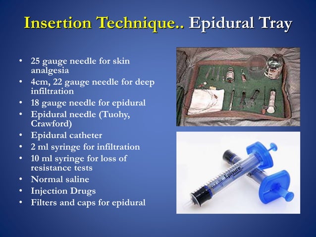 Epidural Injections Ppt