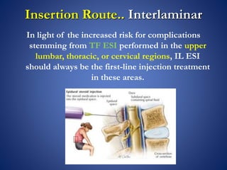 Intrathecal Vs Epidural Injection