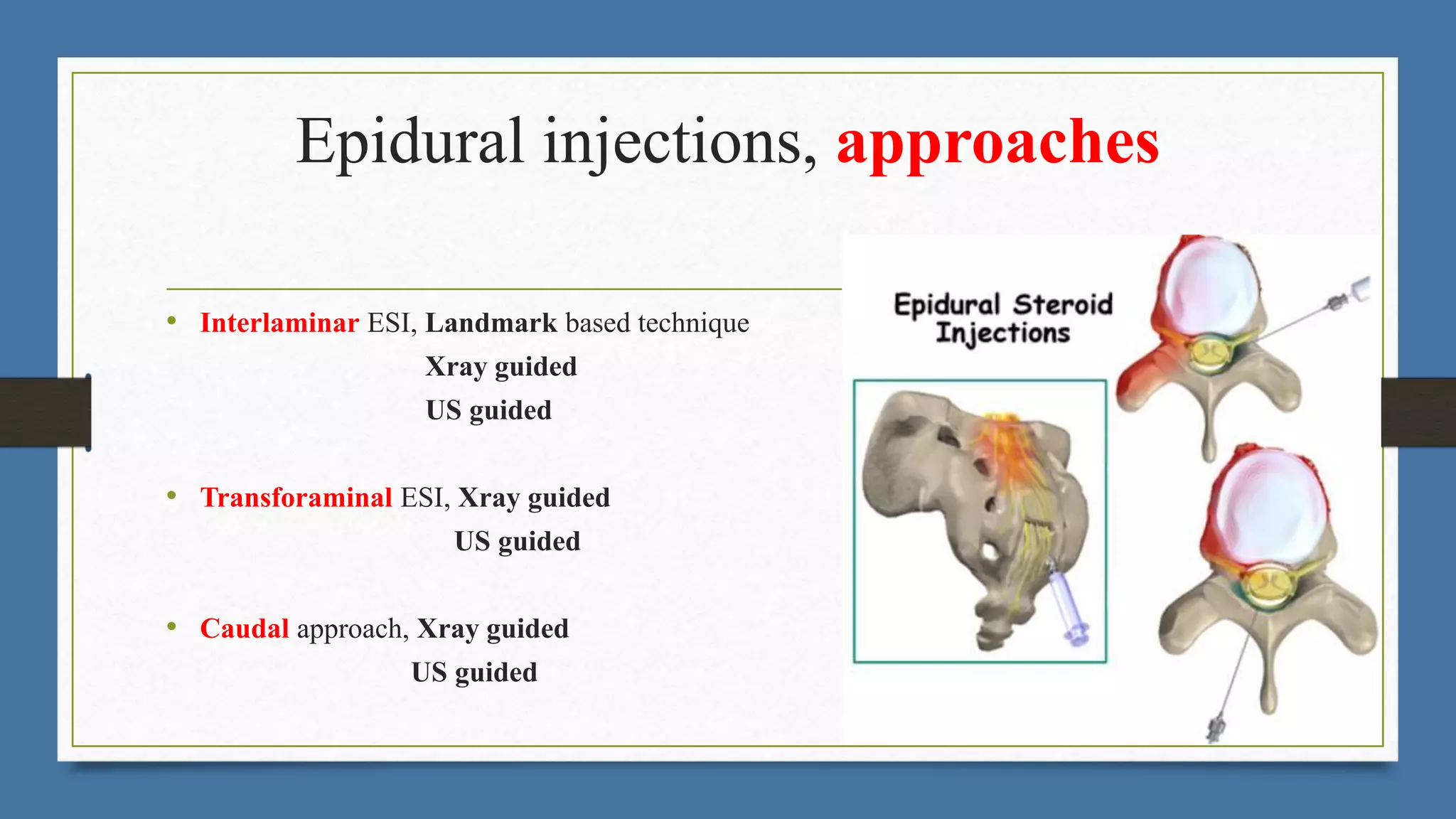 epidural steroids injections .pptx