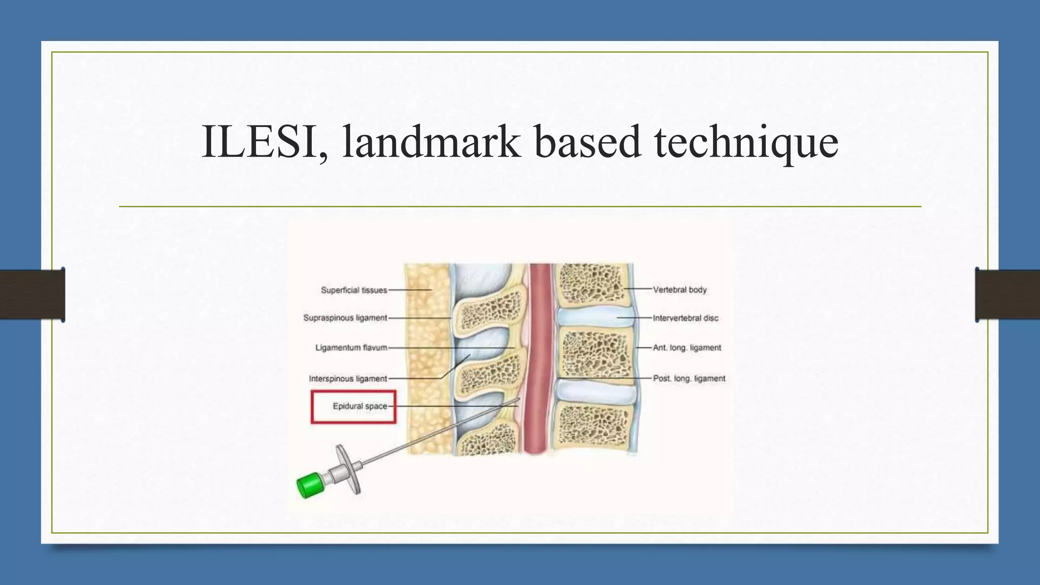 epidural steroids injections .pptx