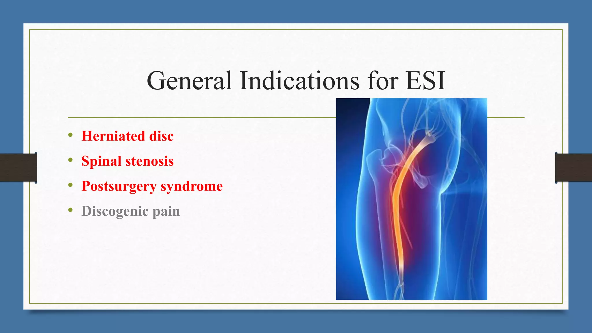 epidural steroids injections .pptx