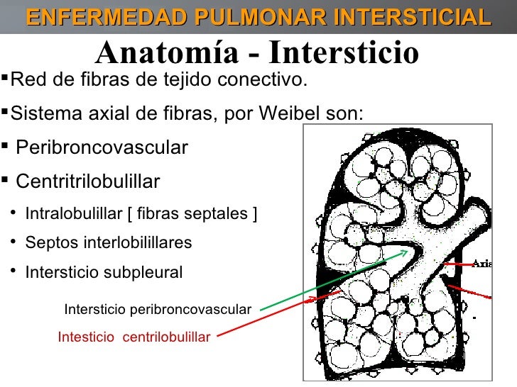 ENFERMEDAD PULMONAR INTERSTICIAL
