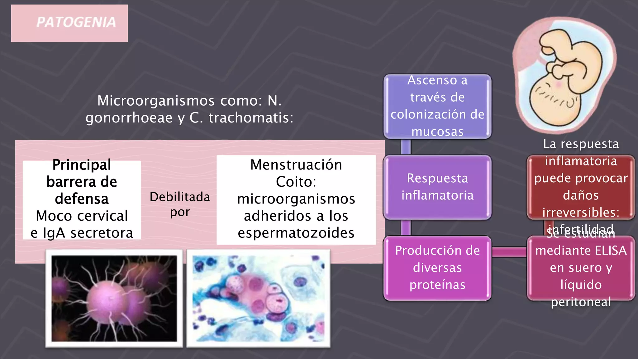 Enfermedad Pélvica Inflamatoria (EPI) | PPTX
