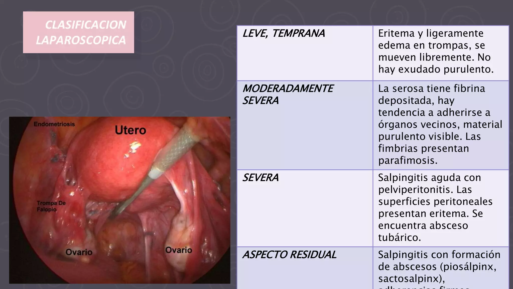 Enfermedad Pélvica Inflamatoria (EPI) | PPT