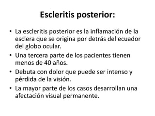 Epiescleritis y escleritis | PPTX
