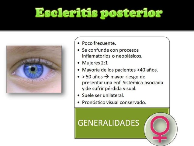 Epiescleritis Y Escleritis | PPTX