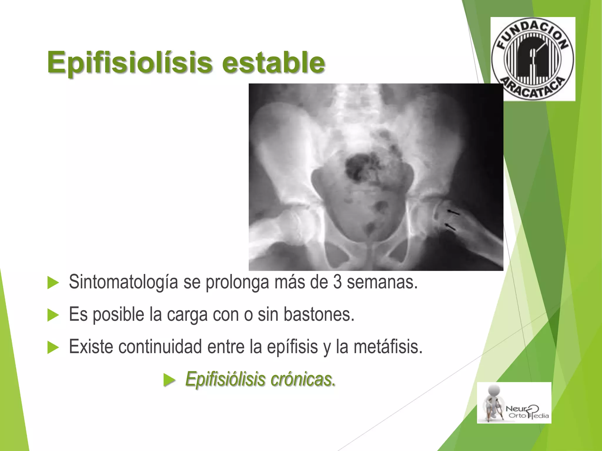 Epifisiólisis de la cabeza femoral | PPTX