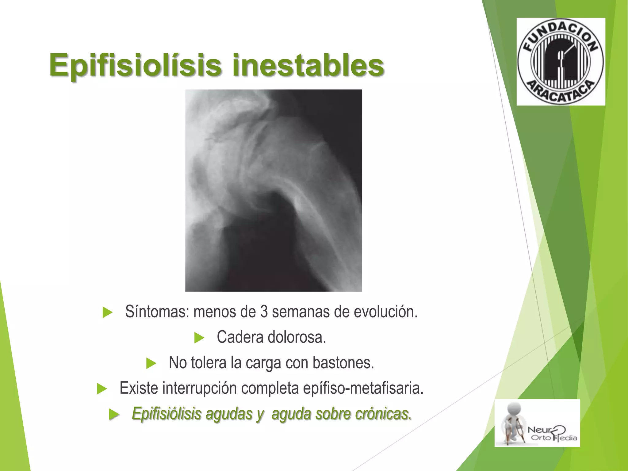 Epifisiólisis de la cabeza femoral | PPT