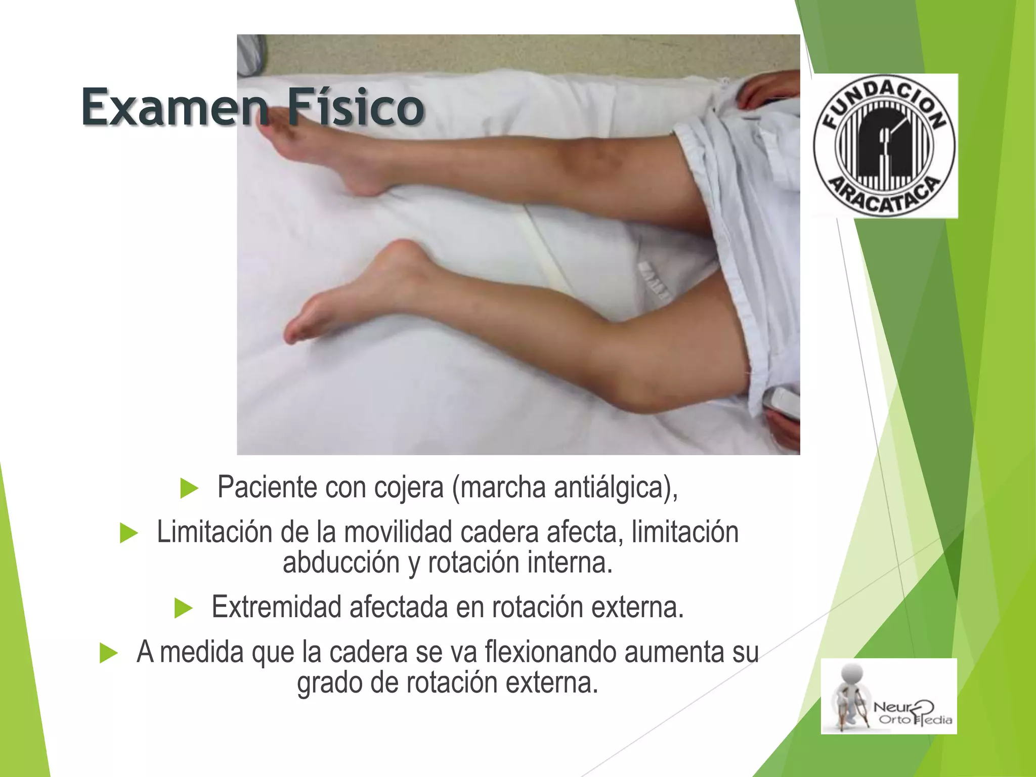 Epifisiólisis de la cabeza femoral | PPTX