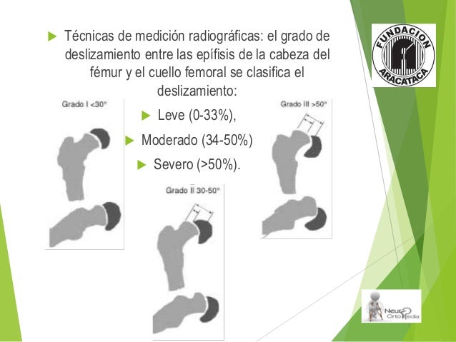 Epifisiólisis De La Cabeza Femoral