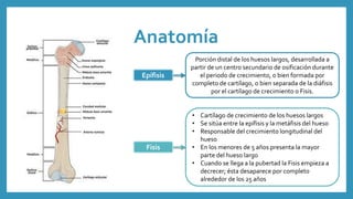 Epifisiolisis | PPTX