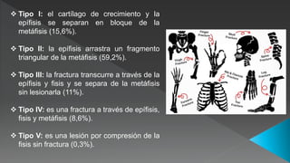 Epifisiolisis.pptx