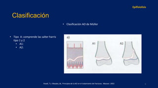 Epifisiolisis breve resumen de la patología | PPTX