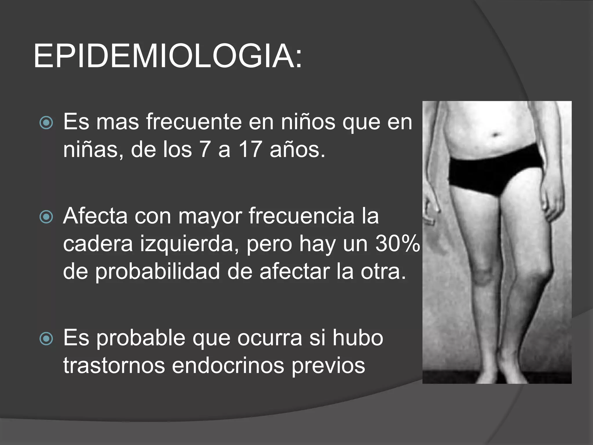 Epifisiolisis capital femoral | PPTX | Bone and Joint Conditions ...