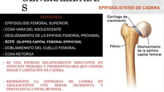 PRESENTACION PPT EPIFISIOLISTESIS_DE_CADERA[1].pptx
