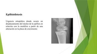 Presentación de Epifisiolistesis GB.pptx