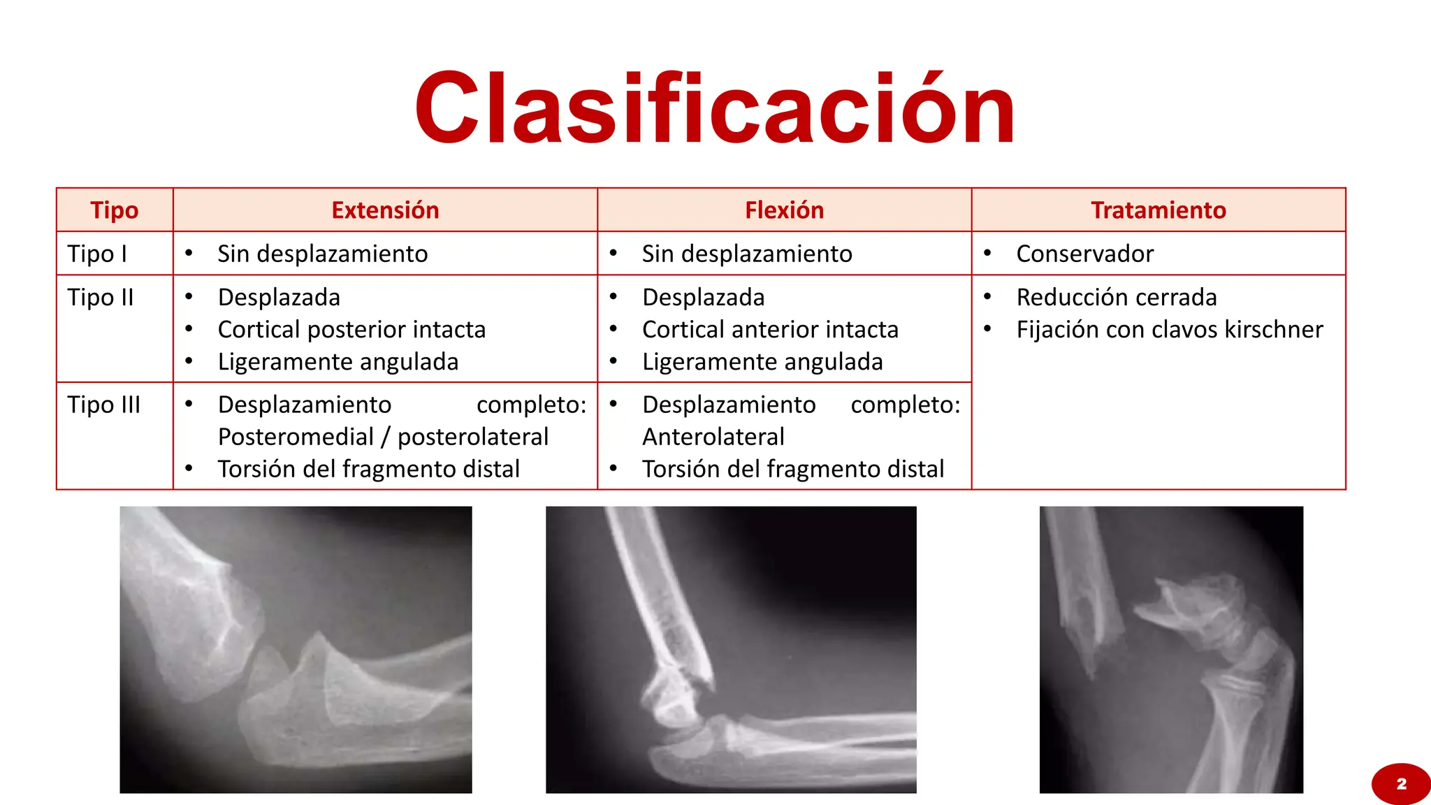 epífisis distal de humero distal revicion.ppt